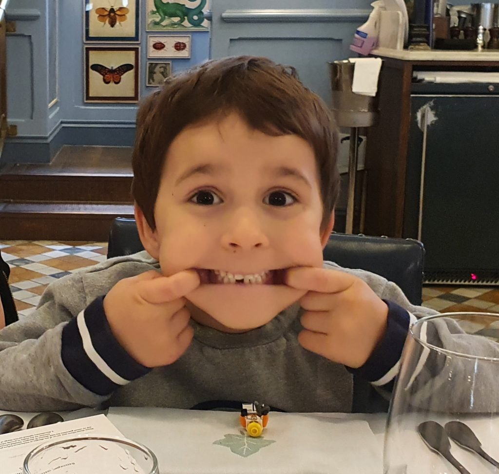 cheeky-face | The Richmond Dentist